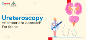 Ureteroscopy transforming and improving the treatment of ureter stone